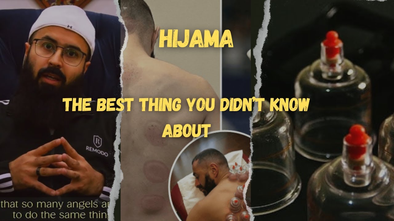 The Art & Science of Hijama (English Subtitles) - YouTube
