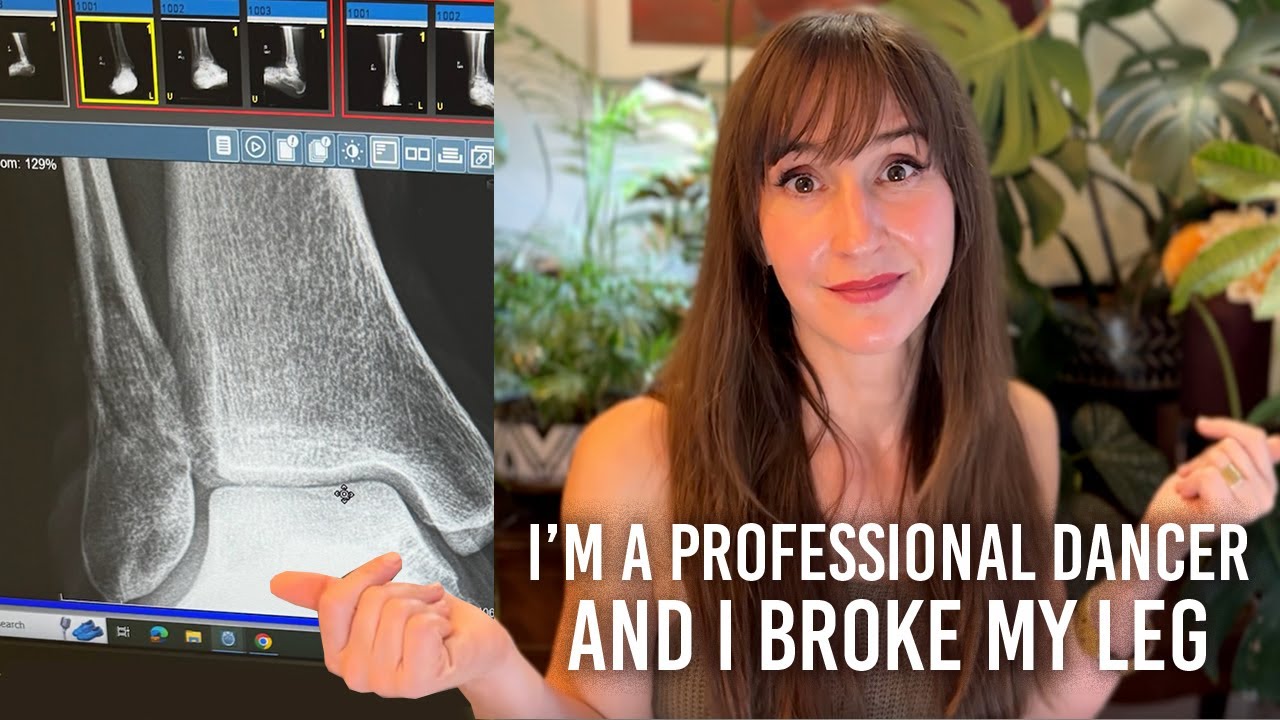 My Broken Ankle - A Professional Dancer's PT, Recovery, & Lingering ...
