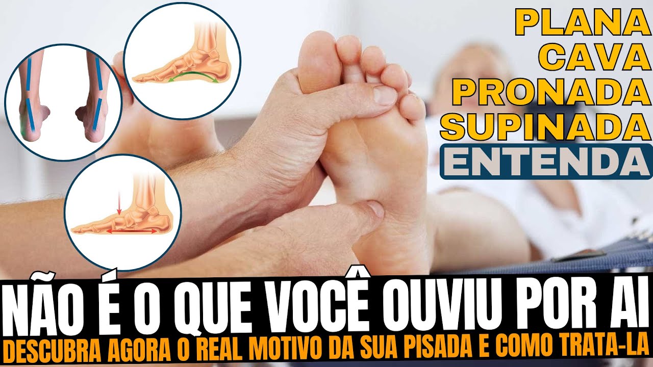 Pisada Torta Como Corrigir - RETOEDU Pisada Torta Como Corrigir - RETOEDU