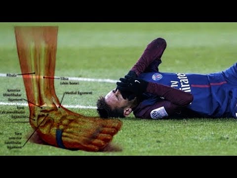 Neymar Jr ⚽ Injury + Marseille Shameful Defenders Hunting on Neymar ⚽ 2018