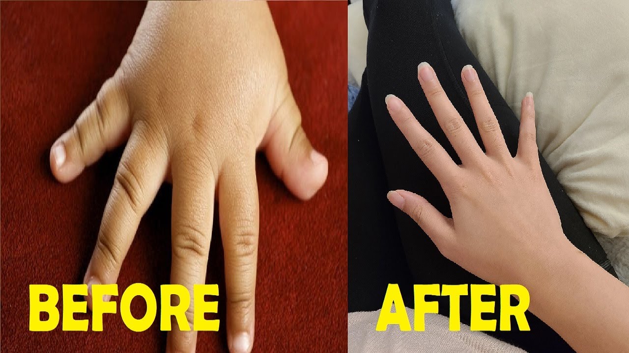 intense 2 minute workout to get slim fingers - YouTube