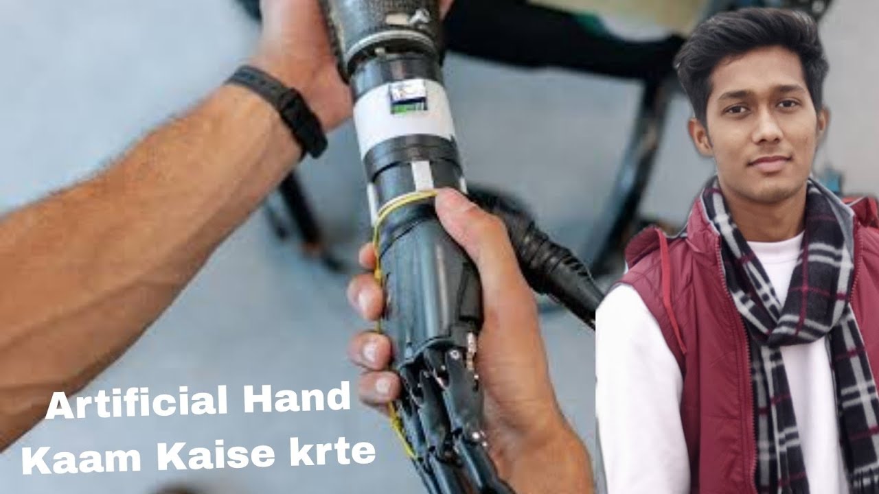 Kaise Artificial Hand Kaam Krte || How Artificial Things Work On Command Of Brain 🧠🛠️ - YouTube