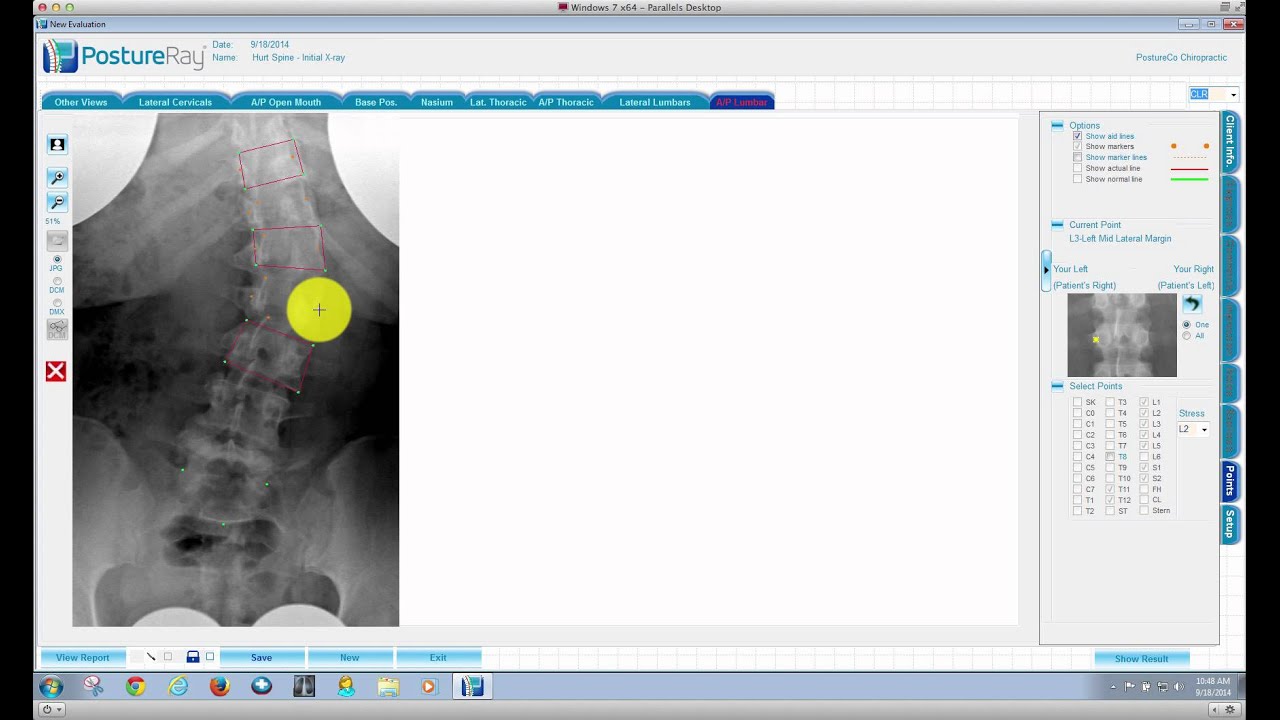 CBP CLEAR both techniques in PostureRay - YouTube