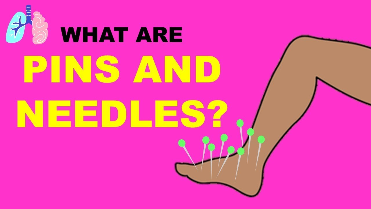 What are pins and needles? - YouTube