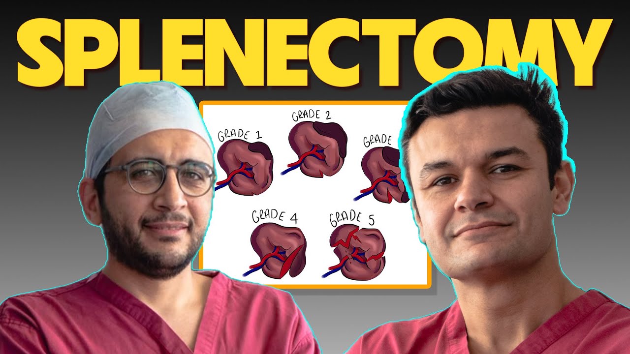 Ep11: splenectomy for FRCS general surgery exams - YouTube
