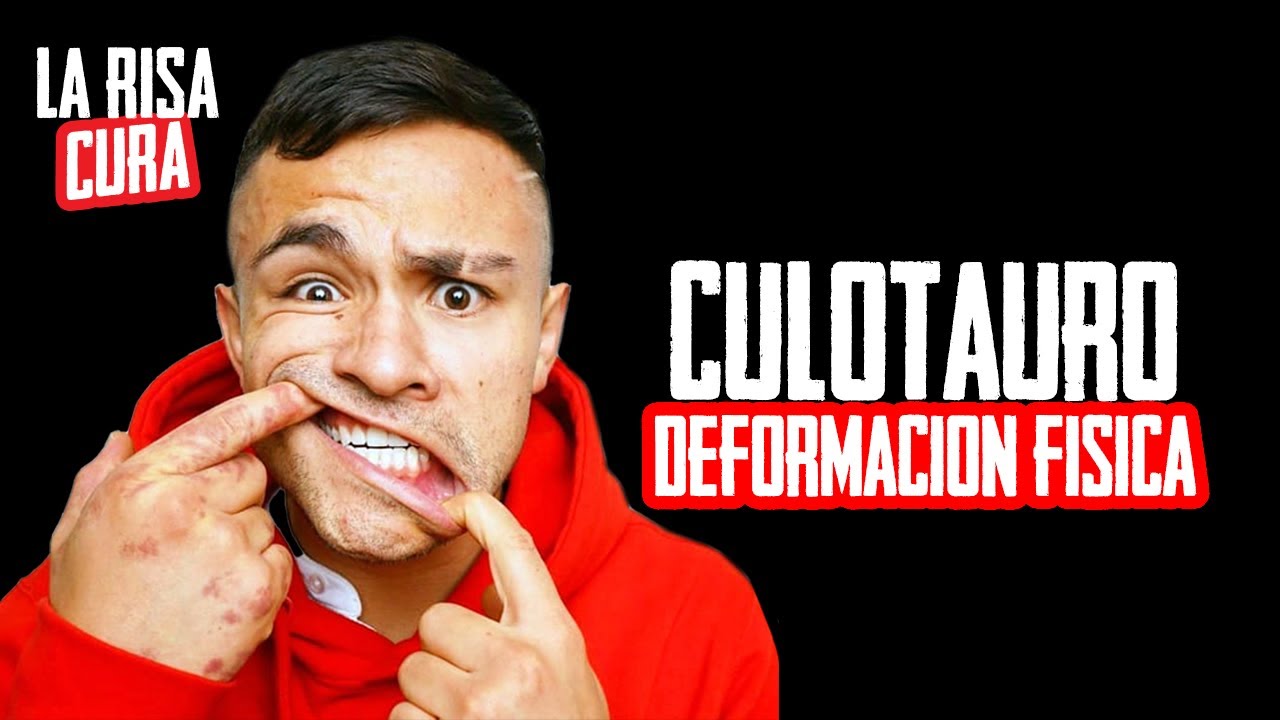 Camilo Diaz nos enseña a reír de la apariencia física - La Risa Cura ...