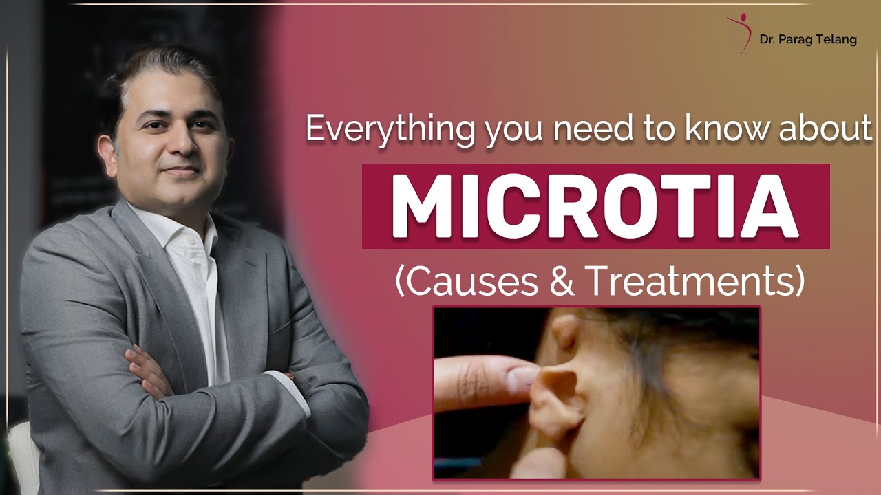 What is Microtia? Microtia causes and how to treat it | Designer Bodyz ...