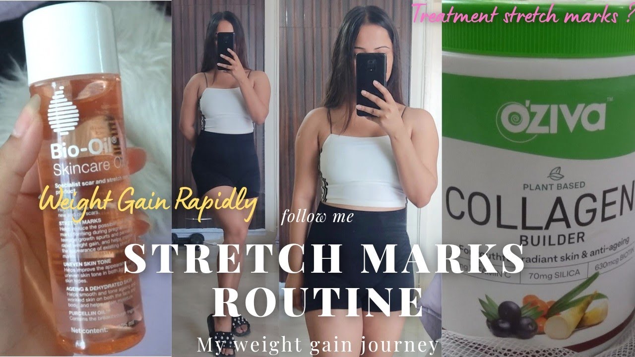 STRETCH MARKS ROUTINE 🍑| Oziva collagen builder| how to prevent ...