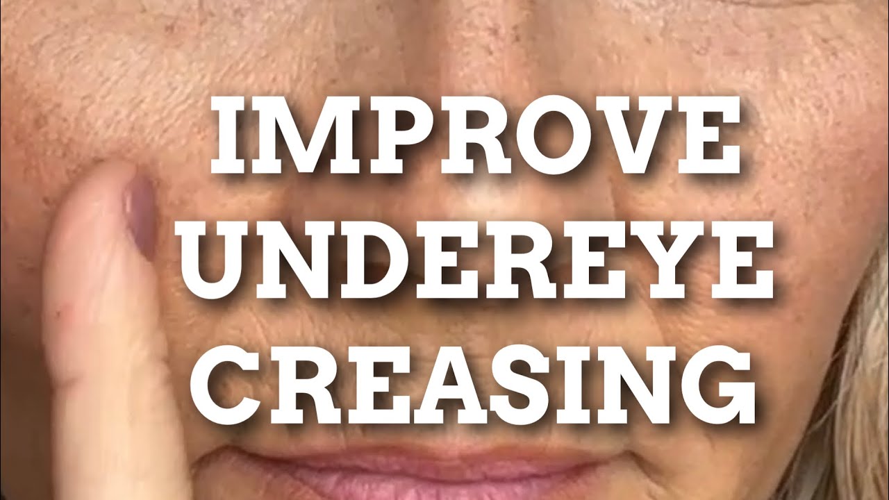 Reduce Under Eye Creasing - YouTube