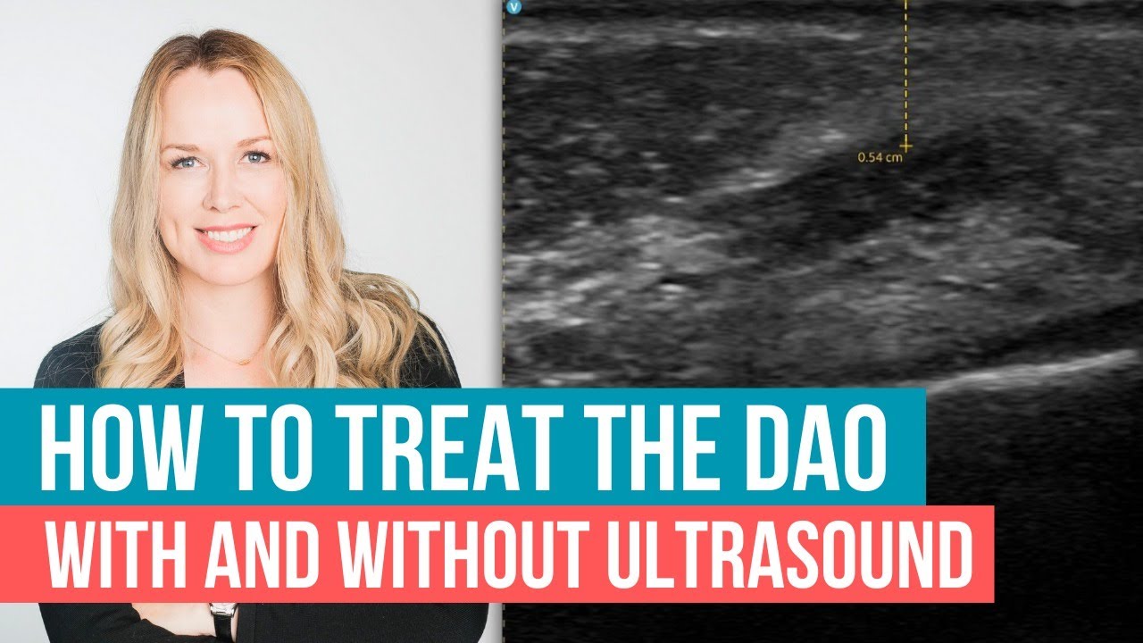 DAO (Depressor Anguli Oris) Treatment Tips, with and without Ultrasound ...