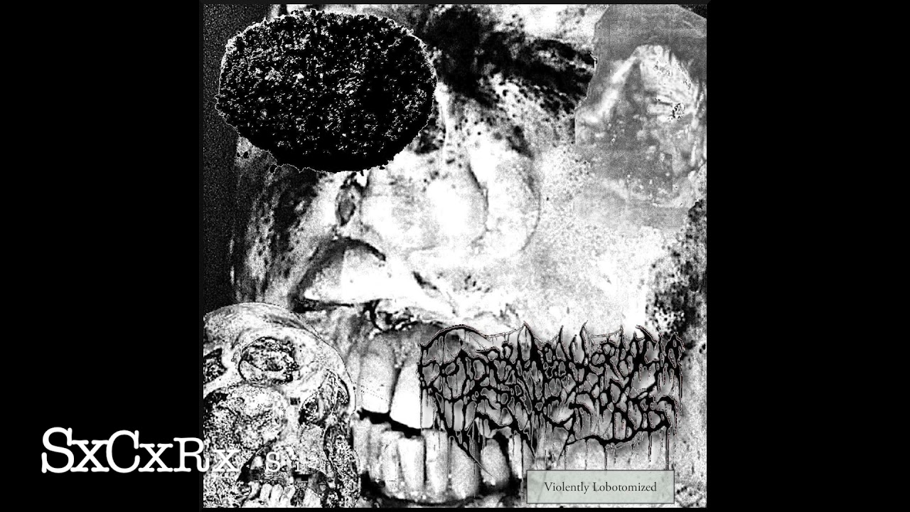 ExVx / Stercoraceous Copremesis Rhinorrhea | Violently Lobotomized FULL ...