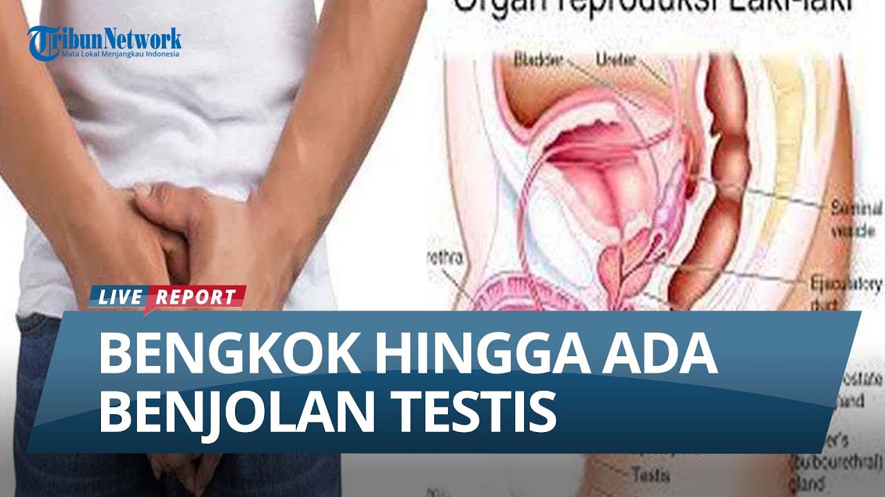 Ini Tanda Alat Kelamin Pria Tidak Sehat, Penis Bengkok - YouTube