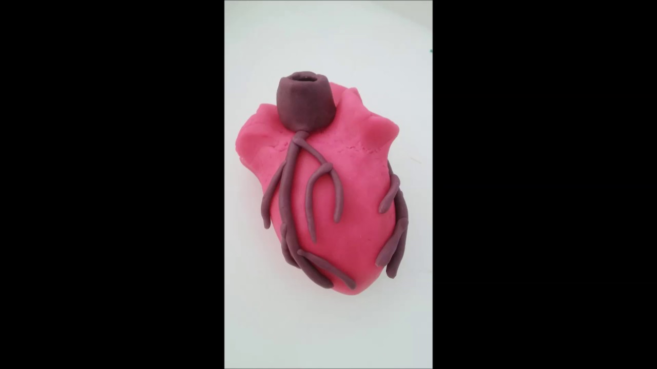 The Process of Myocardial Infarction (A Heart Attack) - A Level Biology ...