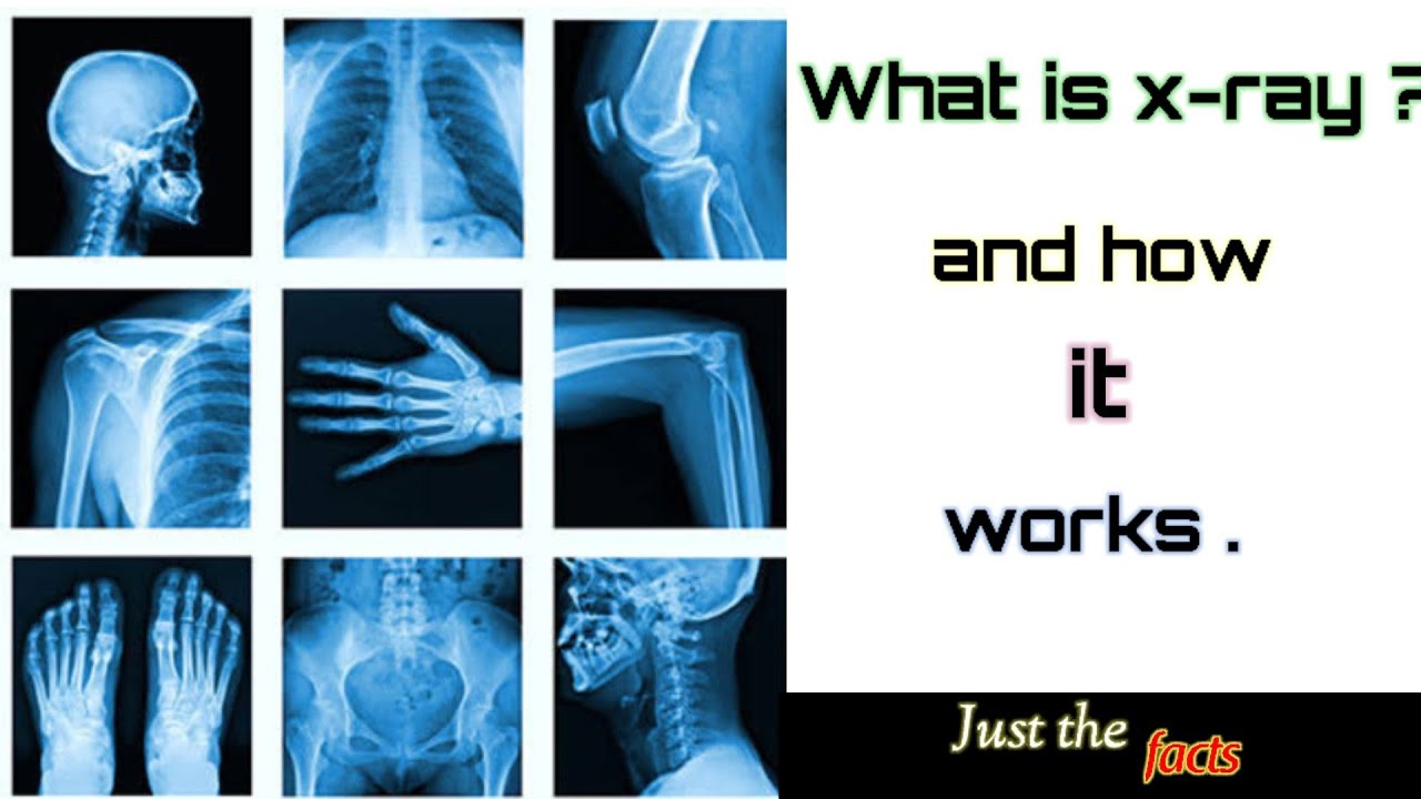 what is x-ray ? and how it works|X-ray in details...|Just the facts ...