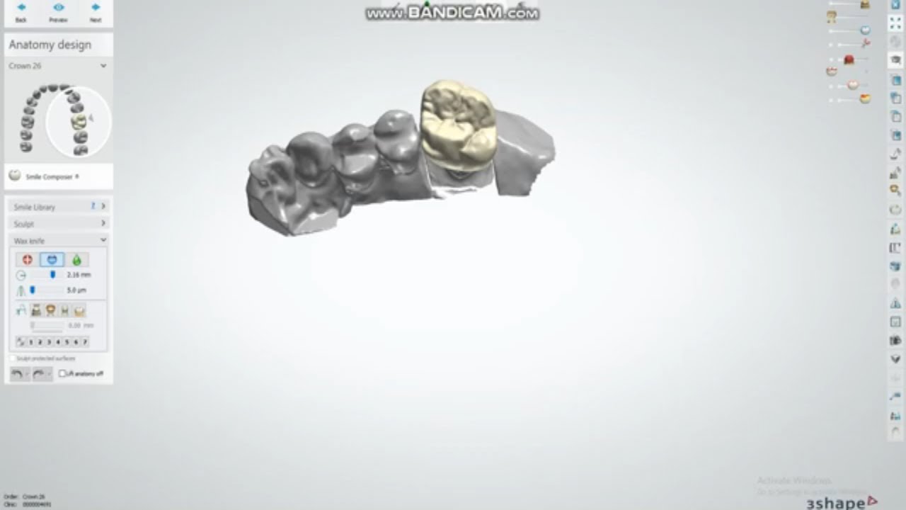 Design full #26 basic on 3shape -Team CadCam chỉnh răng - YouTube