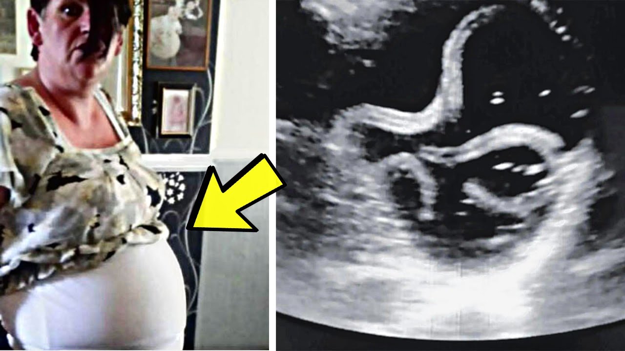 Grandma Belly Kept Growing, When Doctor Reveals What They Found Inside ...