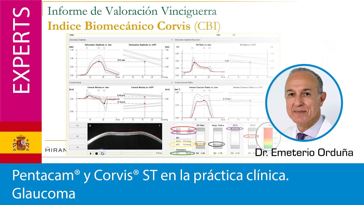 Pentacam® y Corvis® ST en la práctica clínica. Glaucoma - YouTube