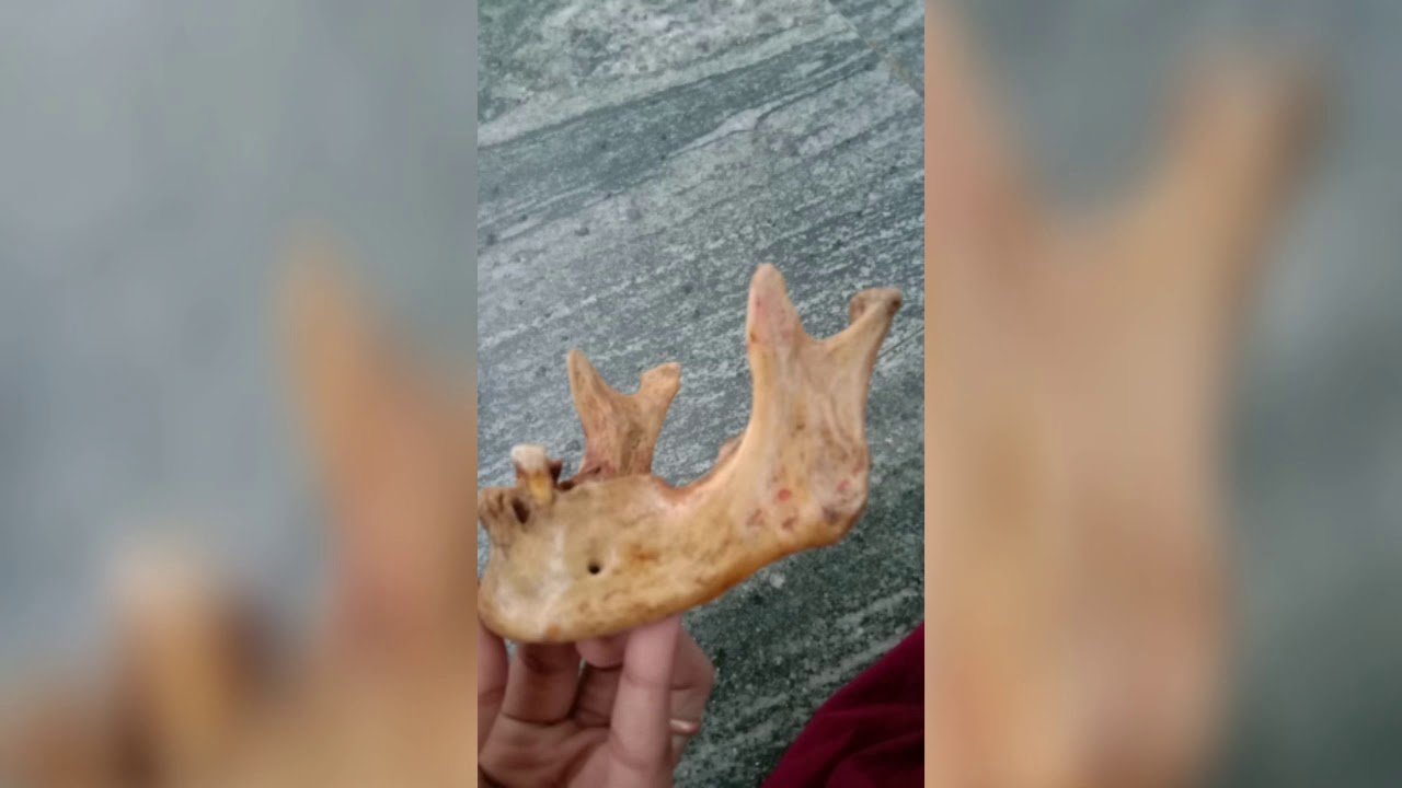 Mandible anatomy part 1 external surface with spotter and viva question ...