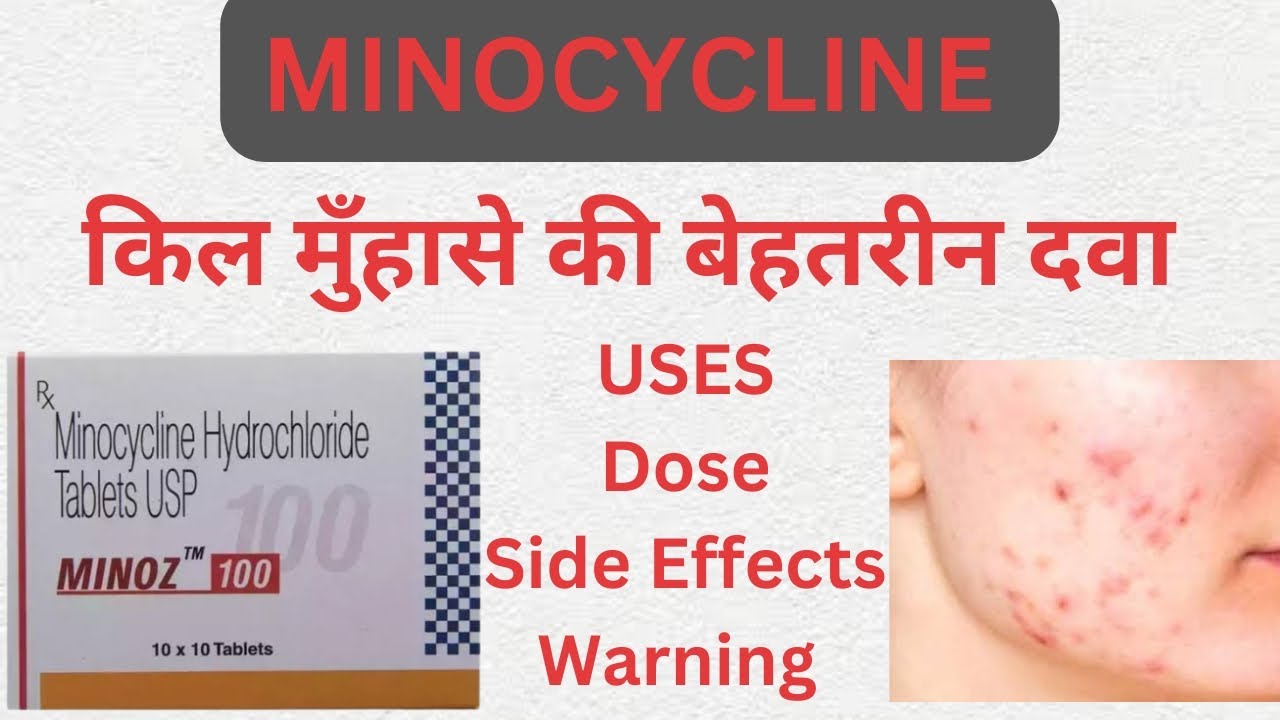 Minocycline Tablet| Mechanism| Pharmacokinetics| Uses| Side Effects ...
