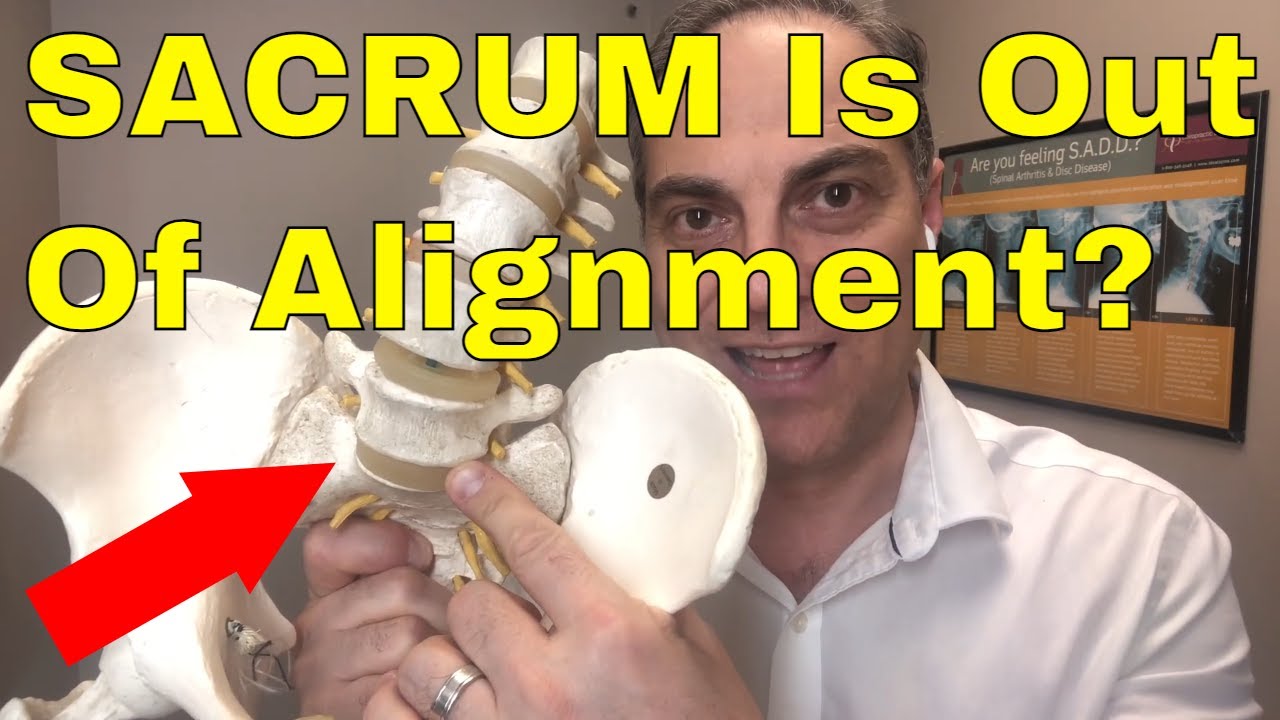 Ep59. What Happens When Your SACRUM Is Out Of Alignment? | Dr Walter ...