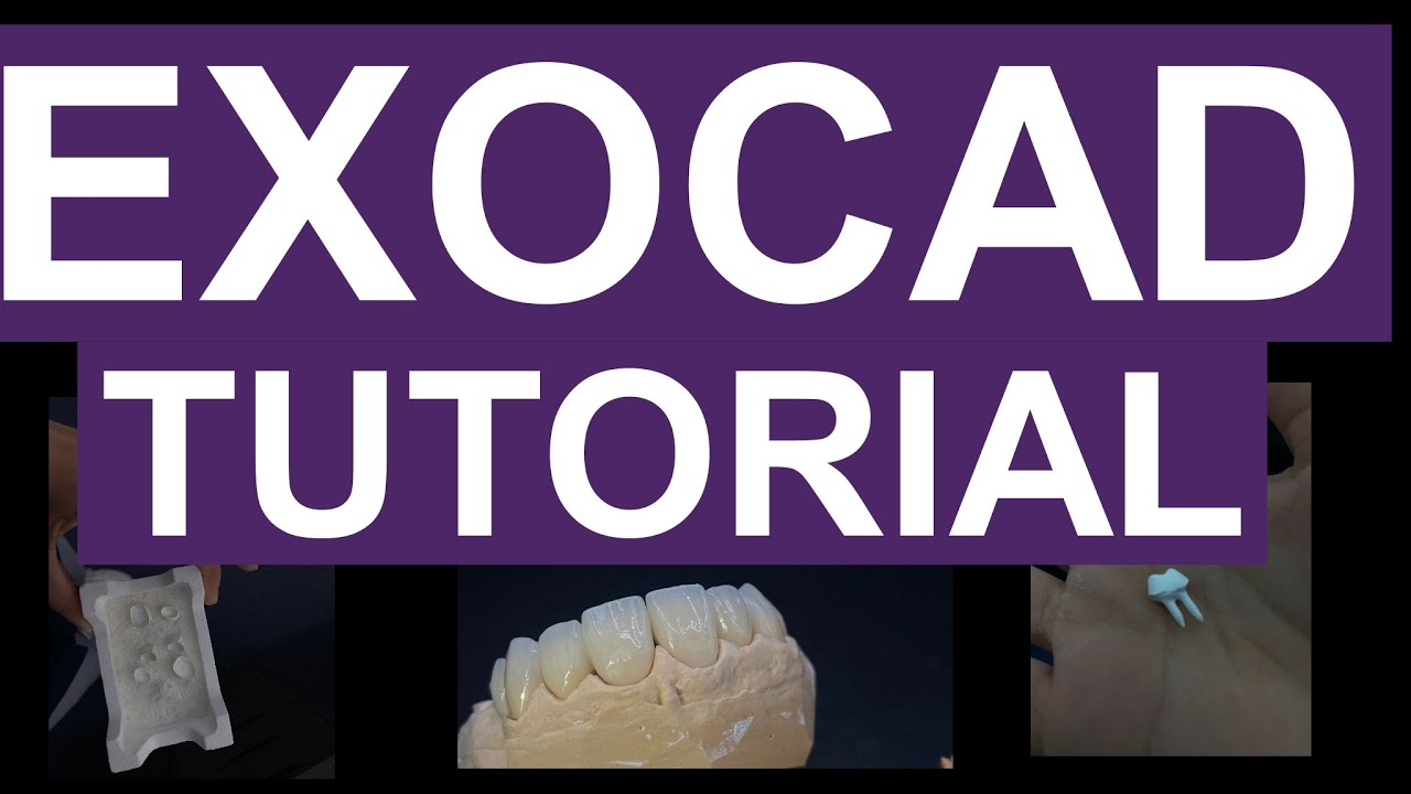 INVATA EXOCAD CU ALINA : inlay/onlay - YouTube