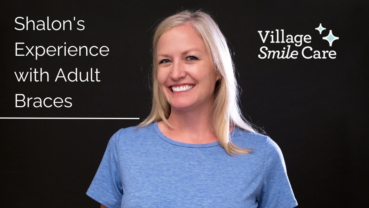 Shalon's Experience With Adult Braces - YouTube