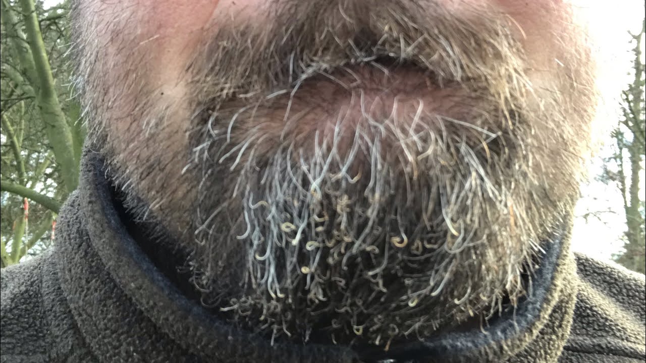 Burned My Beard Making Flatbreads - YouTube