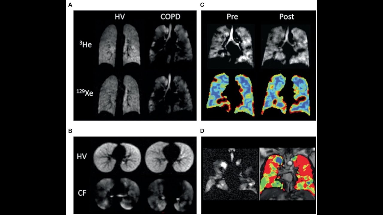 Ultrasound, Computed tomography, Magnetic Resonance Imaging Scan in ...