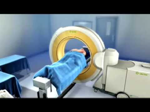 Navigation O-ARM - Full Imaging System Animation - YouTube