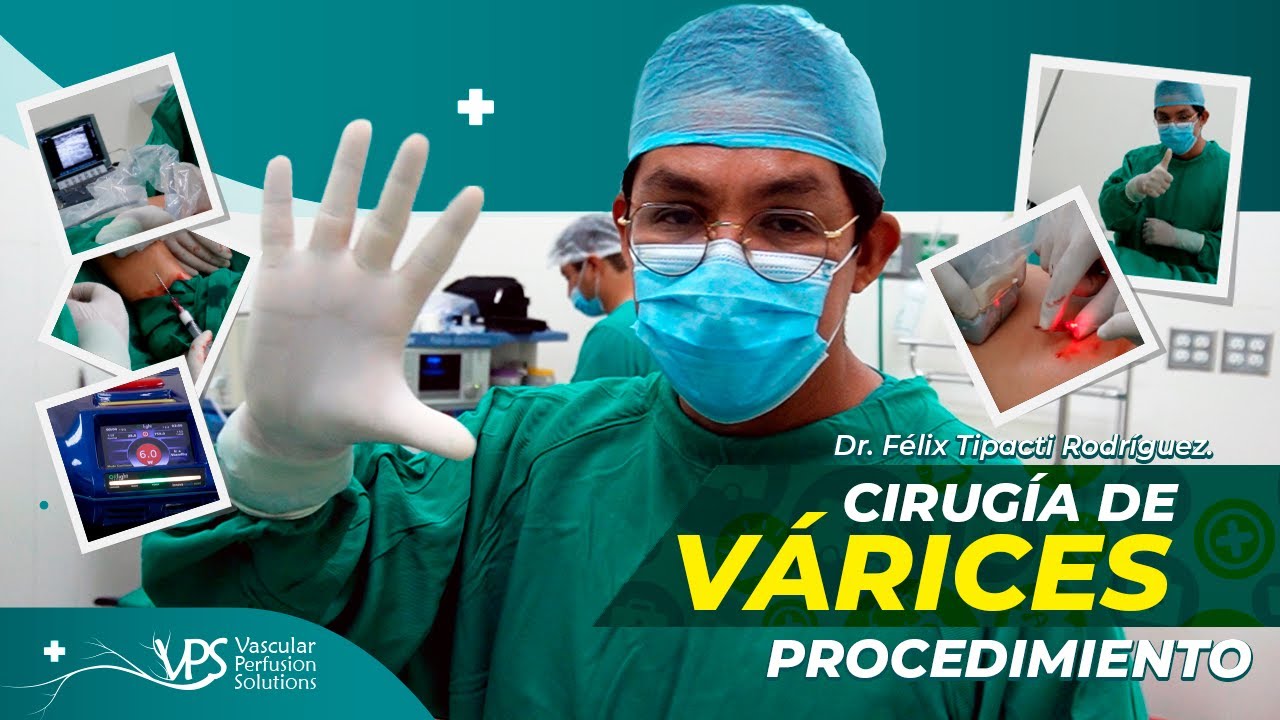 Cirugía de Várices - Procedimiento PASO a PASO - YouTube