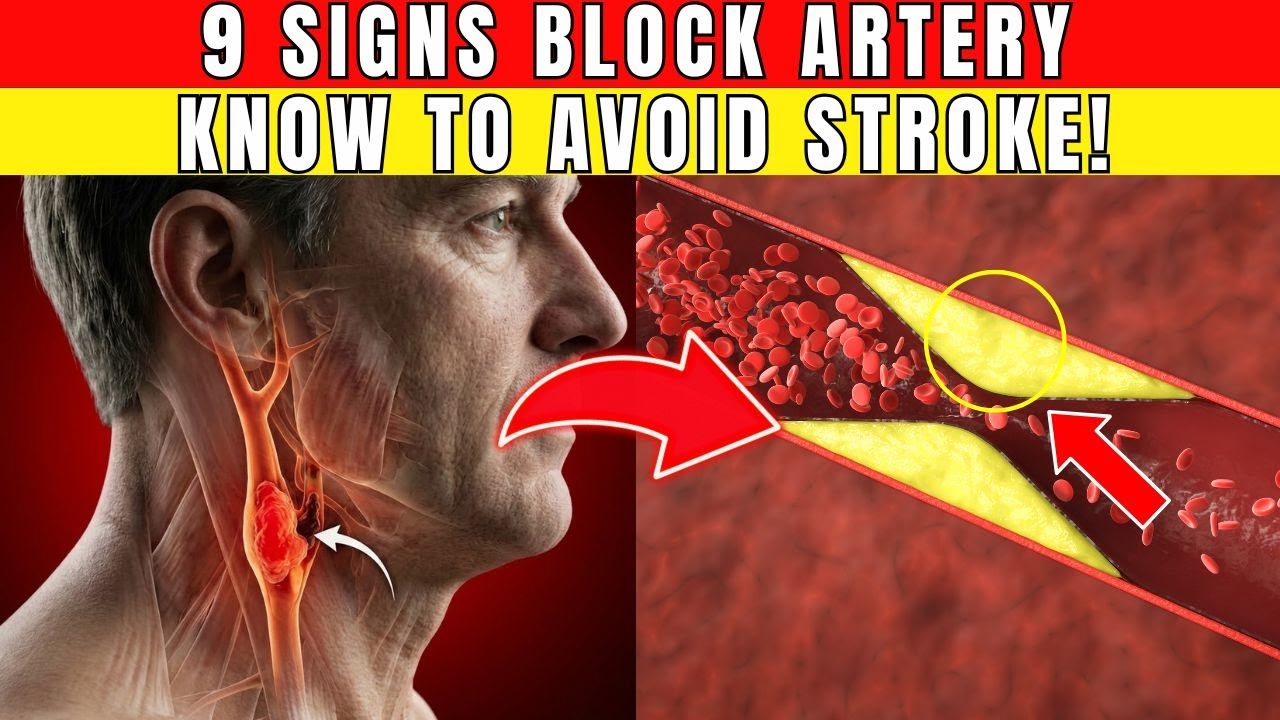 9 WARNING Signs of BLOCKED Arteries in Your NECK (Don't Ignore #5 ...