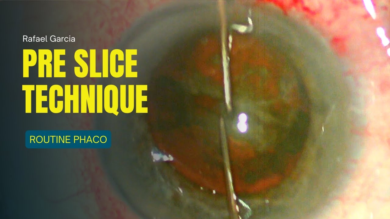 Pre-slice technique - YouTube