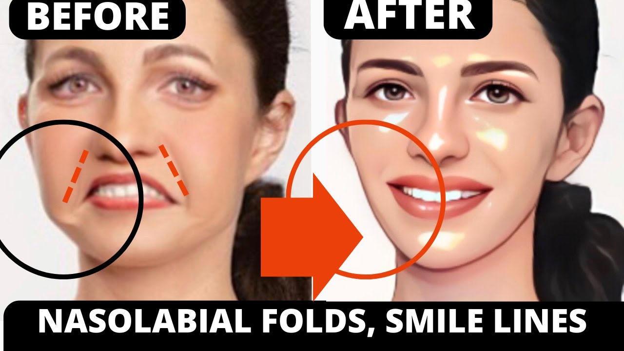 🛑 FACE YOGA FOR NASOLABIAL FOLDS, LAUGH LINES | EFFECTIVE FACE ...