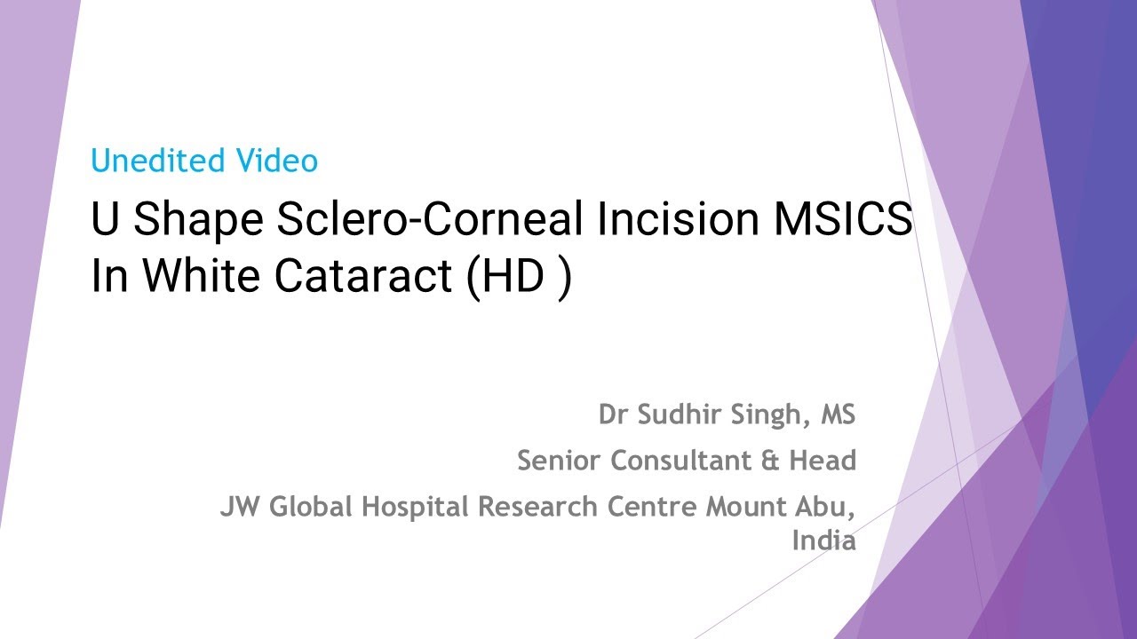 U-Shaped Incision MSICS In White Cataract HD (Unedited) - YouTube