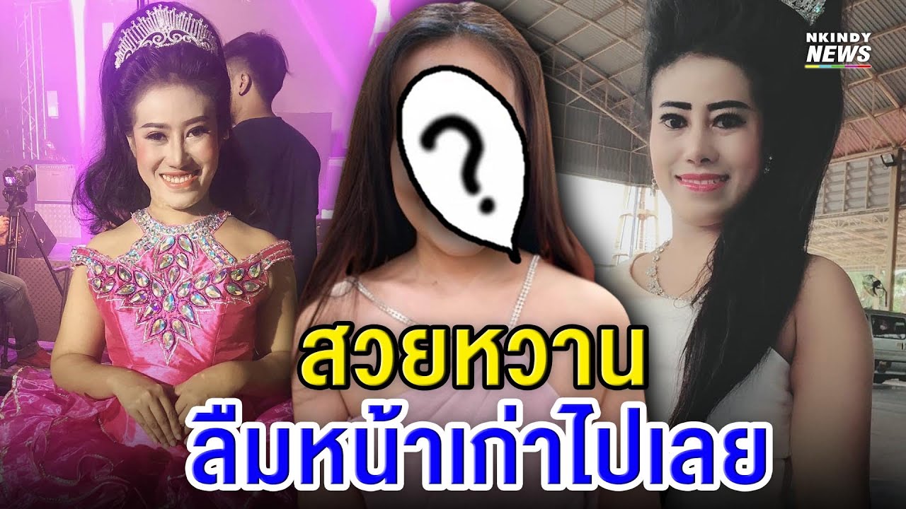 จำแทบไม่ได้ “หนูรัตน์” อัพเดทภาพล่าสุด หลังศัยกรรมผ่านไปสองเดือน เริ่ม ...