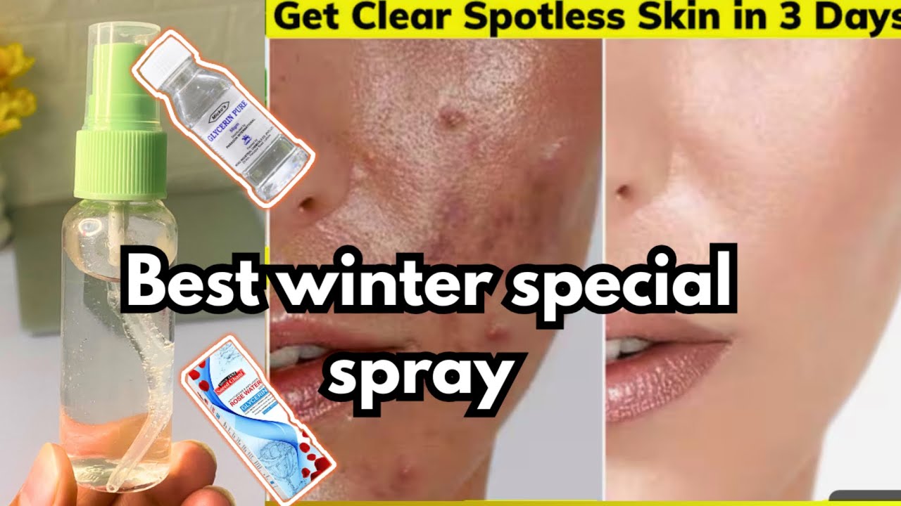 Winter special spray to get glowing skin - YouTube
