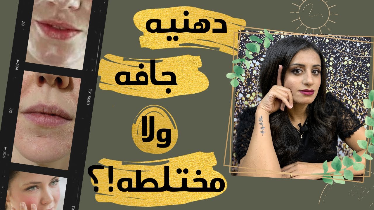 ازاي اعرف نوع بشرتي بسهوله جداا Skin Types Youtube