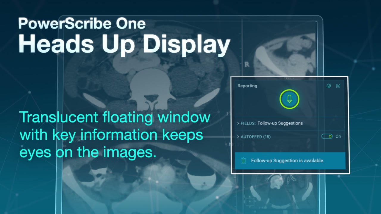 Nuance PowerScribe One - YouTube