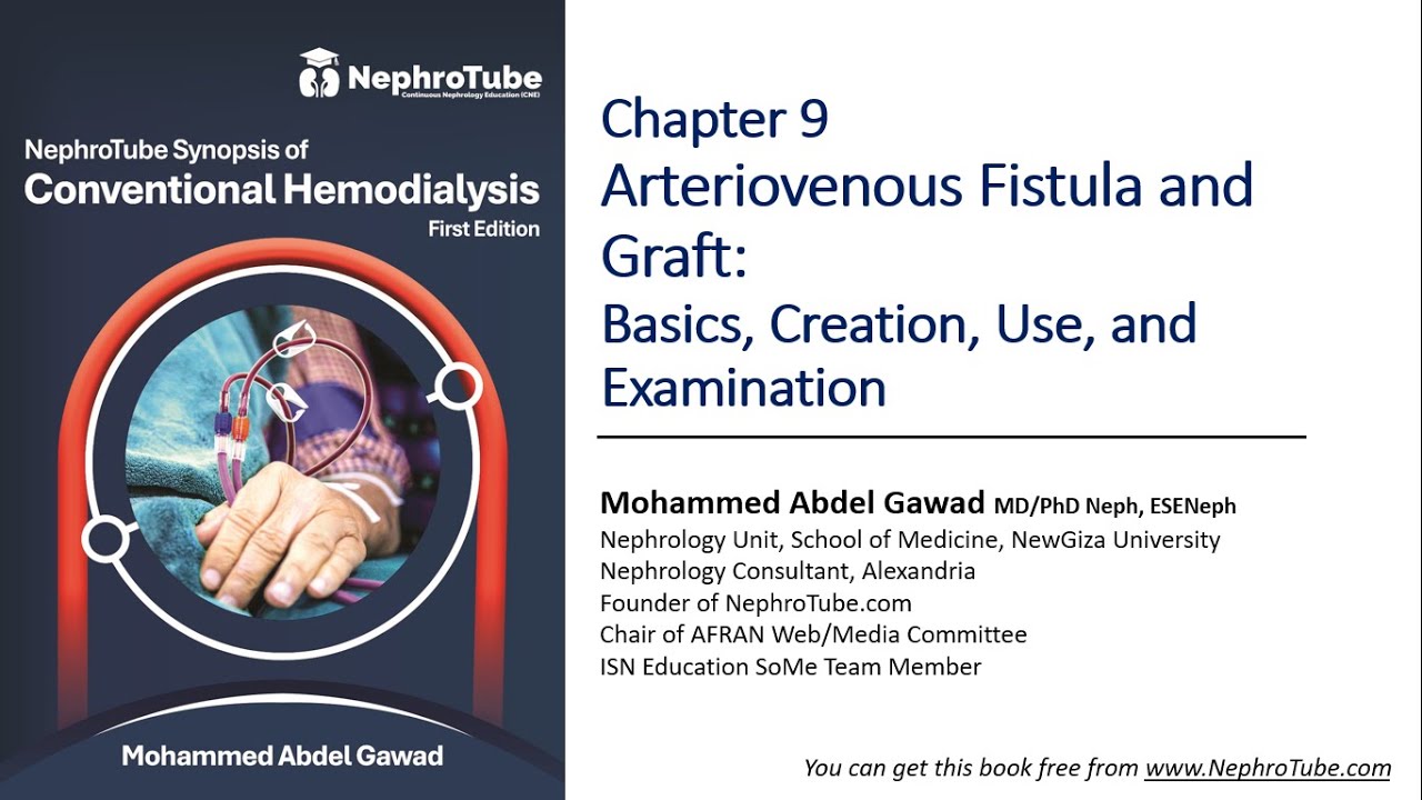 Hemodialysis: Chapter 9, AVF & AVG: Basics, Creation, Use & Examination ...