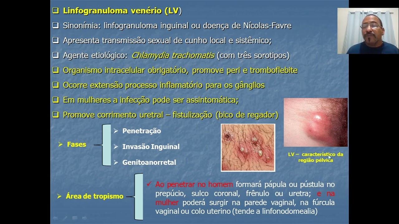 Linfogranuloma Venereo ETS ENARM PRO 2020