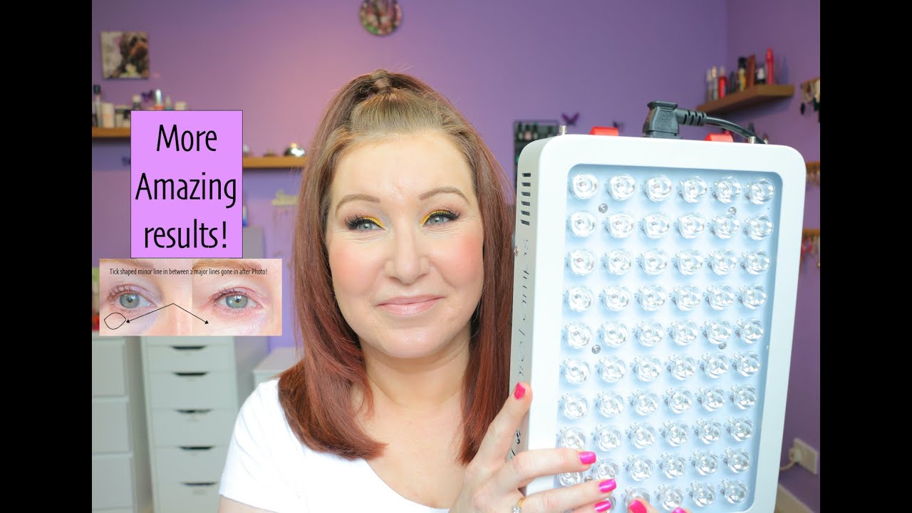 Care Lamp P150 LED Light Therapy - Before & After 1 Month - YouTube