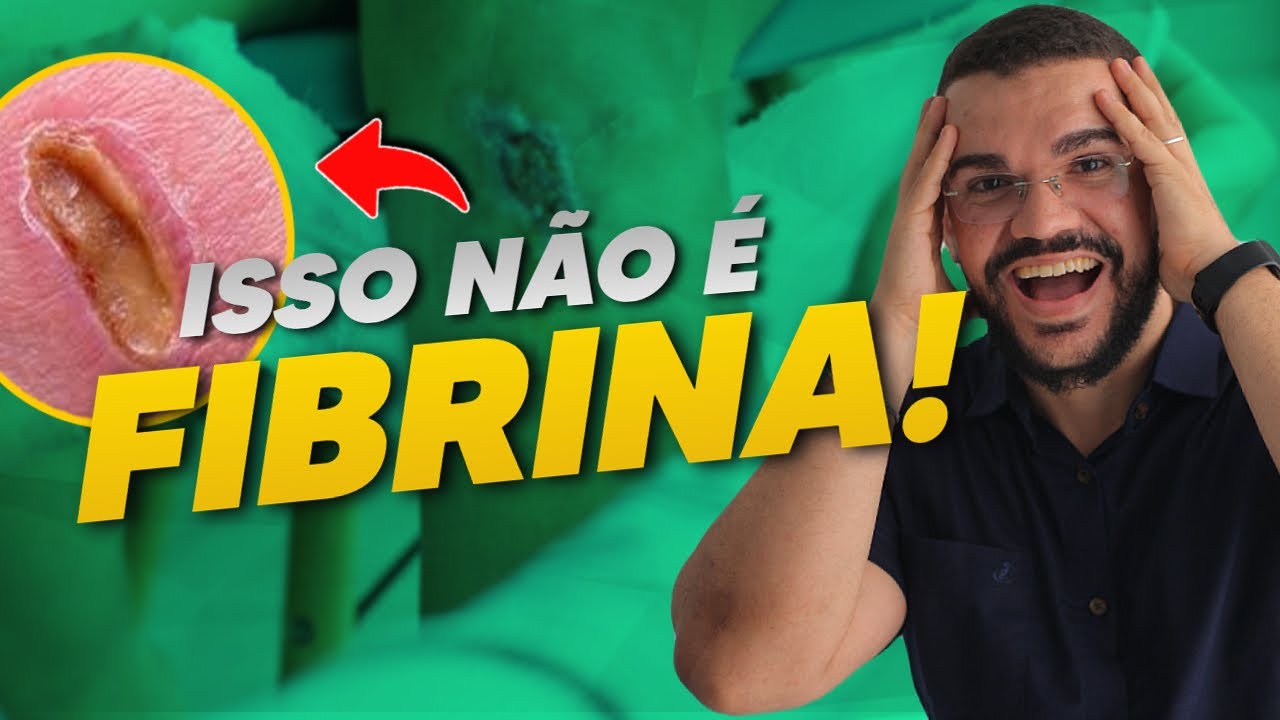 TIPOS DE TECIDOS SOBRE A FERIDA (Fibrina ou Esfacelo)? Entenda a ...