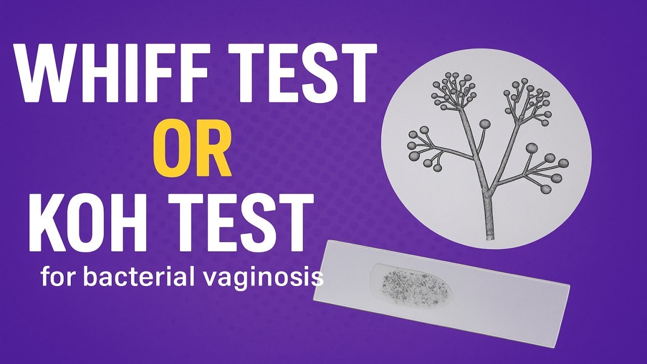 Whiff Test | KOH Test (Potassium Hydroxide Test) | Amine Test ...