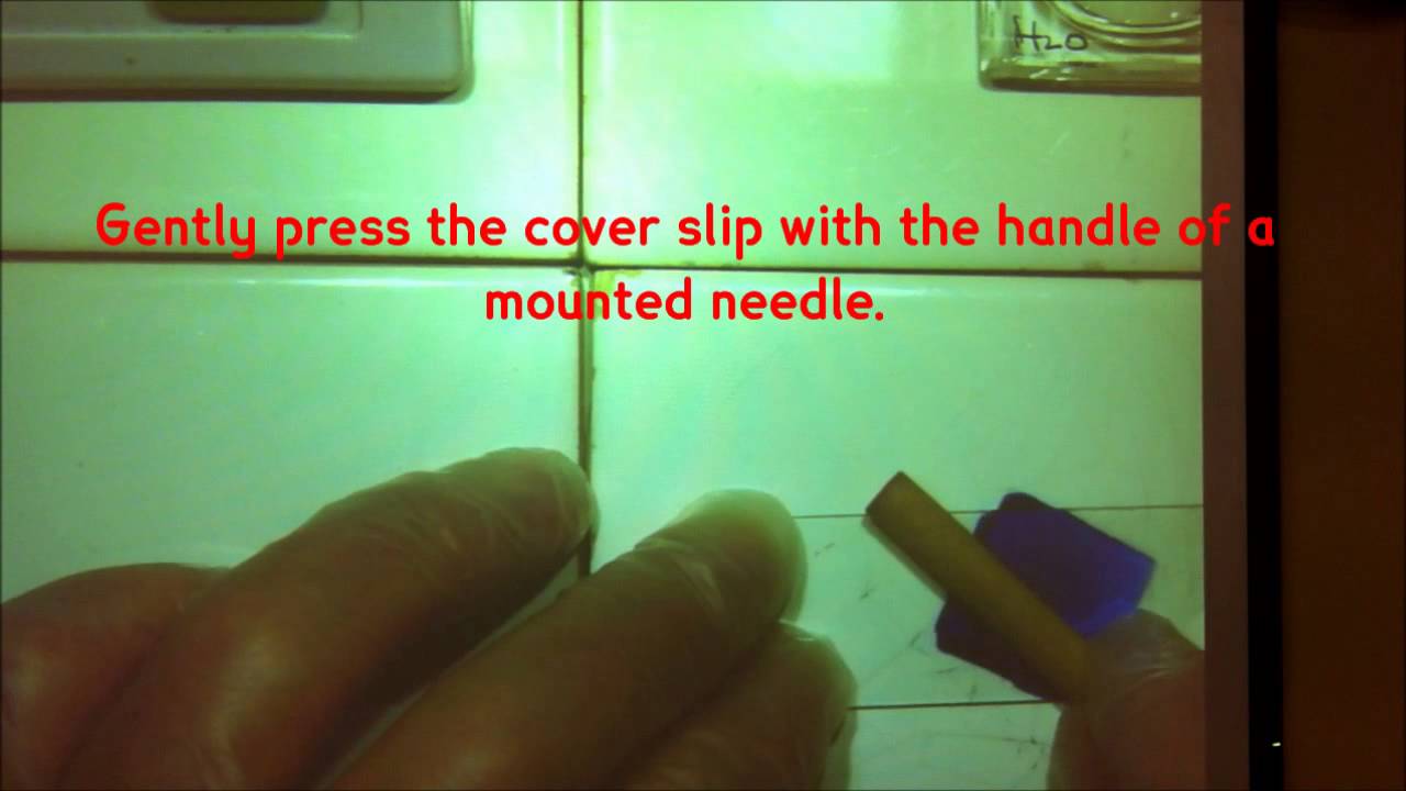 Mitosis- preparation of root tip squashes. An alternative method. - YouTube