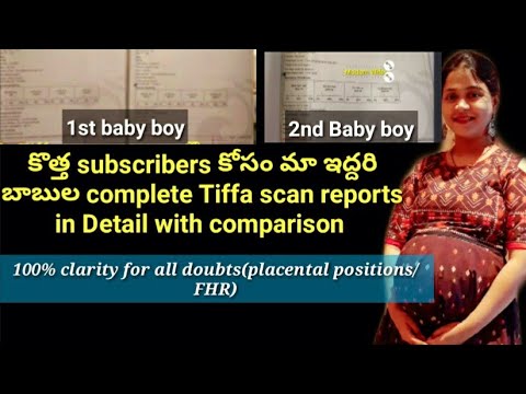 My Baby boy's complete TIFFA SCAN Reports||ultrasound gender reveal ...
