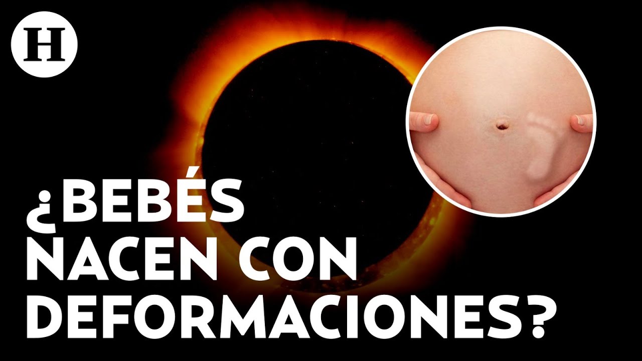 ¿Eclipses afectan a embarazadas? Estos son los mitos alrededor de este ...