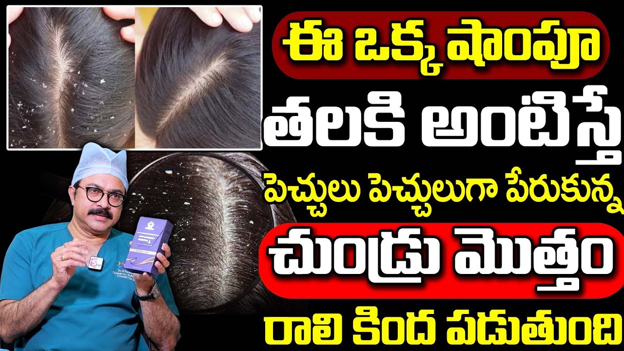 Solution for Dandruff | Get Rid of Dandruff | Anti - Dandruff Shampoo ...