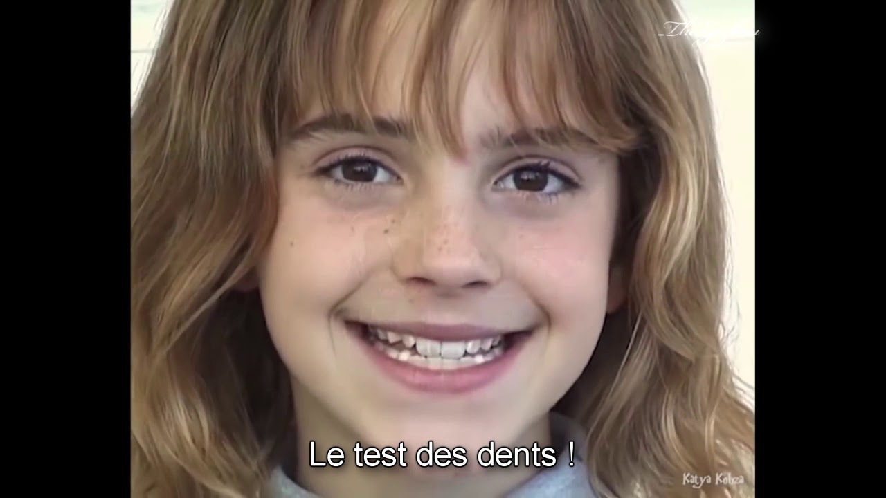 [VOSTFR] Emma Watson essaye les fausses dents d'Hermione Granger (2000 ...