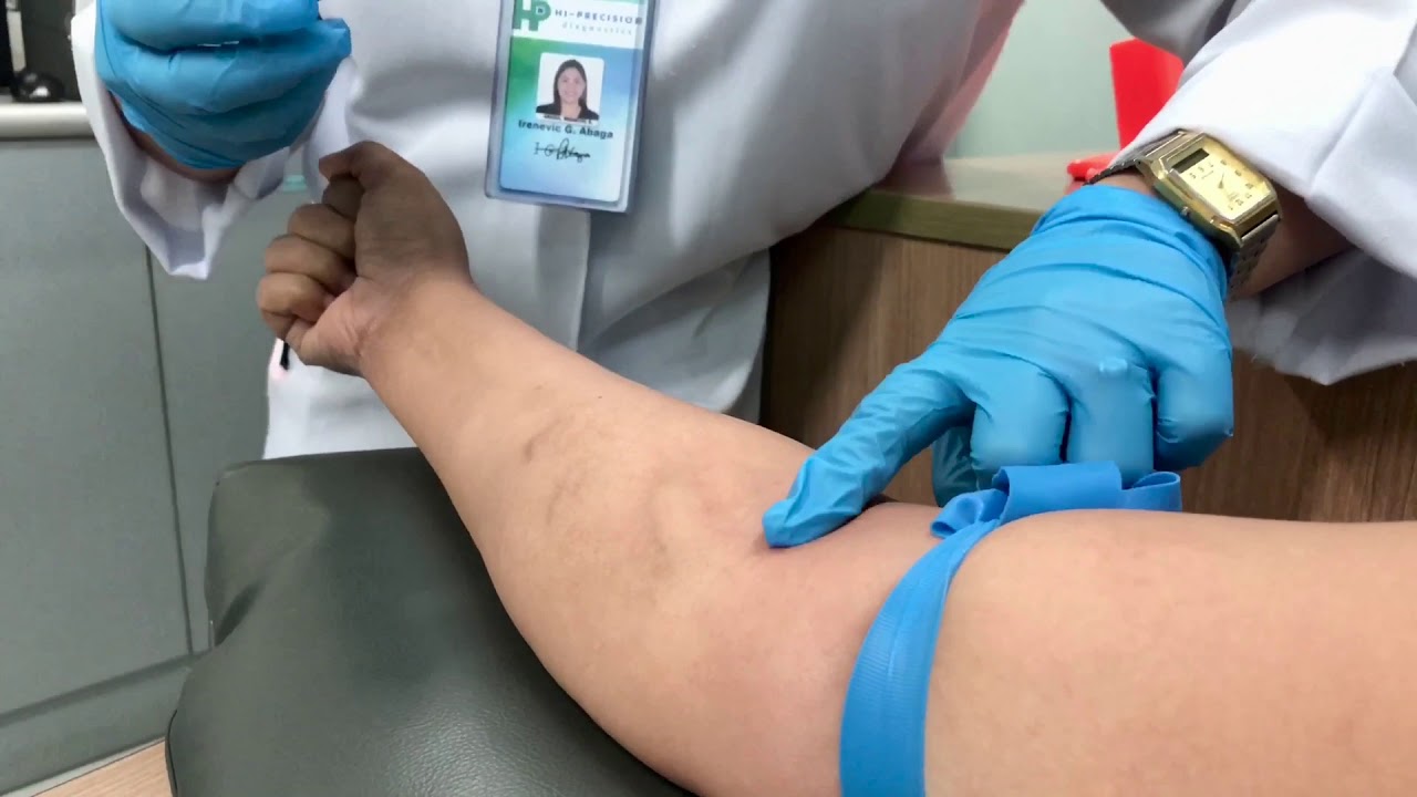 Blood test before Chemo | Alpha Trajeco - YouTube