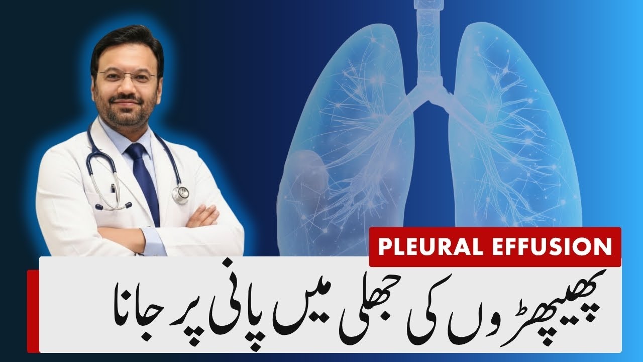Tuberculosis Without Cough? Yes, It Happens in Lymph Nodes! # ...